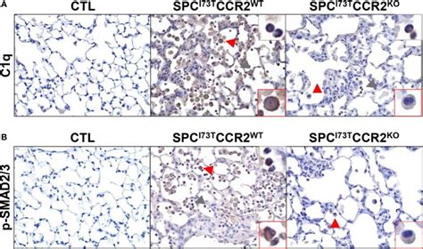 Phospho Smad3 Ser425 Antibody Pa5 37636