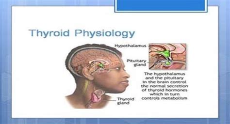 Download Free Medical Thyroid Disease Powerpoint Presentation