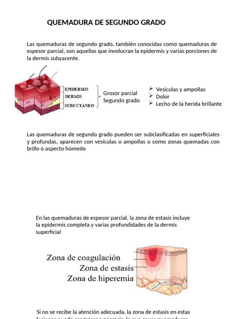 Quemaduras De Segundo Grado Guía Esencial Pdf