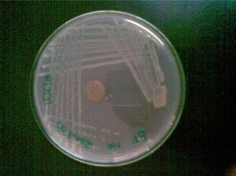 Isolated Endosulfan Degrading Bacteria Download Scientific Diagram