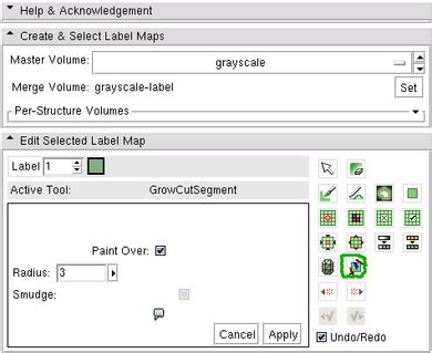 Modules GrowCutSegmentation Documentation Slicer Wiki