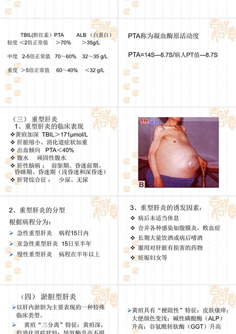 病毒性肝炎及护理ppt模板卡卡办公