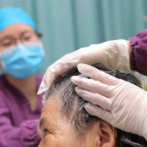 经常头痛到底是什么问题？医生提醒：这两种头痛千万别硬扛！部位症状上颌