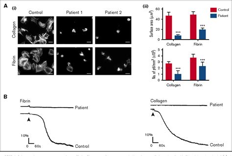 Figure 1 From Fibrin And D Dimer Bind To Monomeric Gpvi Semantic Scholar