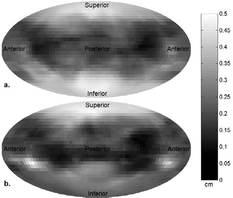 Radial Distance Maps For The Prostate Map A Mean Radial Distance Download Scientific
