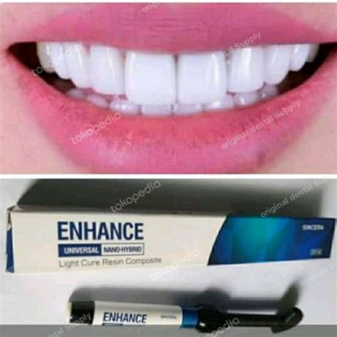 Promo Composite Enhance Tambalan Gigi Komposite Komposit Dental Veneer