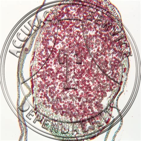 Porella Mature Sporophyte Median Ls Prepared Microscope Slide