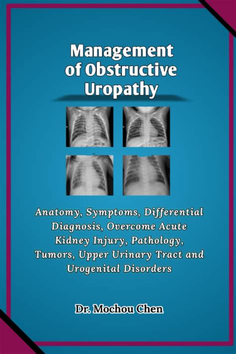 Management Of Obstructive Uropathy Anatomy Symptoms Differential
