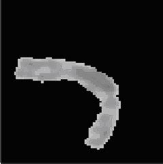 Separation Overlapping Chromosome Images A Original Image Of Two