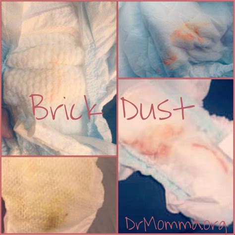 Uric Acid Crystals In Newborn Diaper
