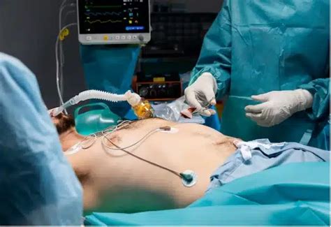 Exploring The 5 Different Types Of Lipomatic Surgery Medical Tourist