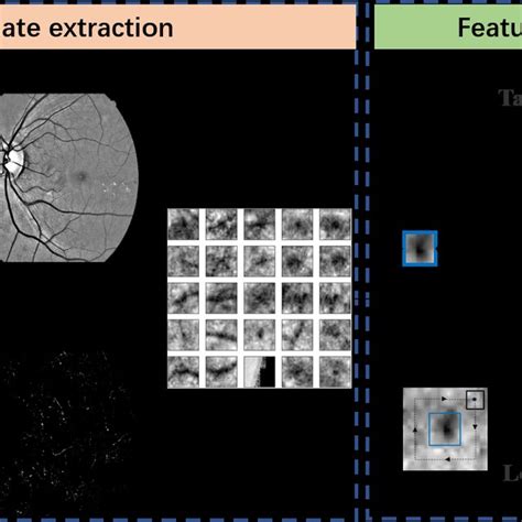 Schematic Diagram Of The Automatic Ma Detection Method Including