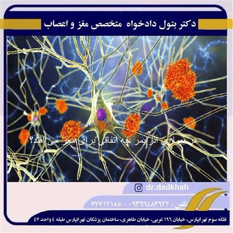 آلزایمر چگونه بر مغز تأثیر می گذارد؟ دکتر بتول دادخواه متخصص مغز و