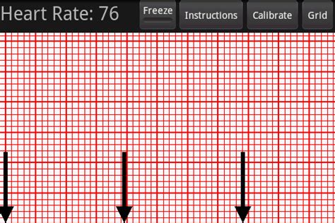 EKG Apps Android App Reviews