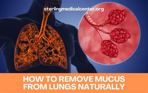 How To Remove Mucus From Lungs Naturally A Medical Guide To