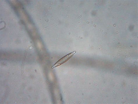 Navicula Radiosa