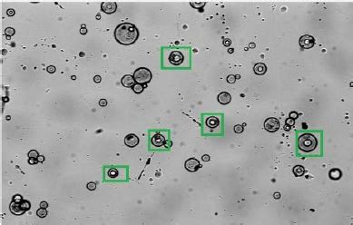 Cells Image After Applying The Gaussian Filter Download Scientific Diagram