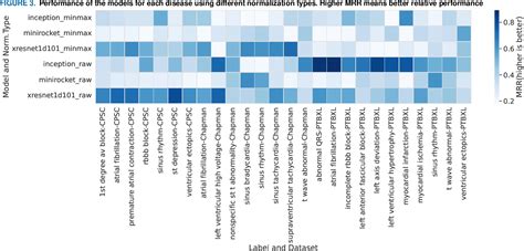 Exploring Best Practices For Ecg Signal Processing In Machine Learning Paper And Code Catalyzex