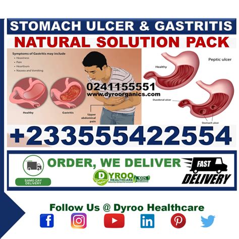 Herbal Medicine For Peptic Ulcer In Ghana Effective Remedies