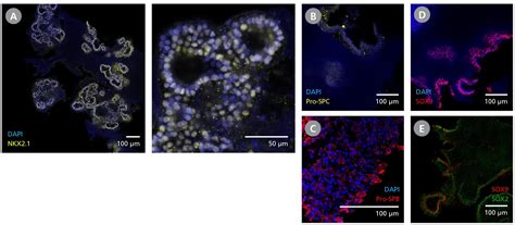 Stemdiff™ Branching Lung Organoid Kit Stemcell Technologies