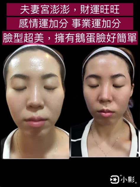 夫妻宮」就是大家所知道的「太陽穴」🥰 絕大部份都會用瀏海來遮掩，😵 夫妻宮凹陷時，會讓臉看起來沒有那麼鵝蛋型、圓潤，比較不討喜🥶 還會使得眼尾