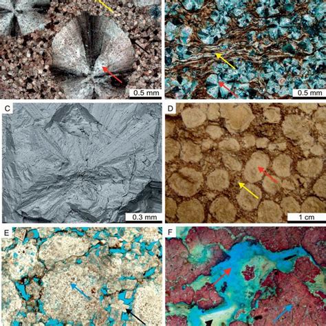 Pdf Influence Of Diagenesis On The Quality Of Lower Cretaceous Pre Salt Lacustrine Carbonate