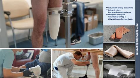 Proteze Plasting Ortopedija