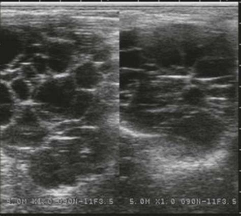 30 Equine Female Infertility Flashcards Quizlet