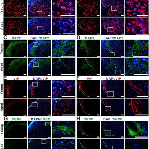 The Positivity Of Neun A B Map2 C D Vip E F And Cgrp