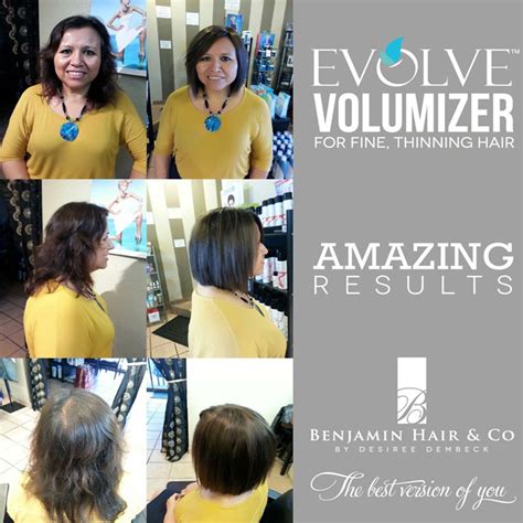 Amazing Result Now Wearable Solution Of Evolve Volumizer For Fine