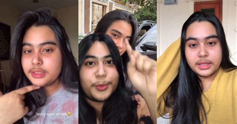 Dah Guna Laser Tapi Masih Tumbuh Gadis Miliki Misai Dan Janggut