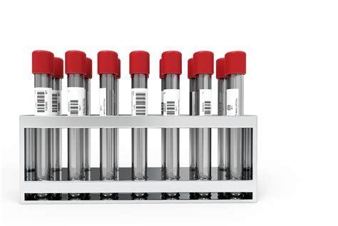Step Lab The Electrodynamic Testing Machines Experts