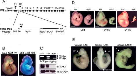 Tak1 But Not Tab1 Or Tab2 Plays An Essential Role In Multiple Signaling Pathways In Vivo