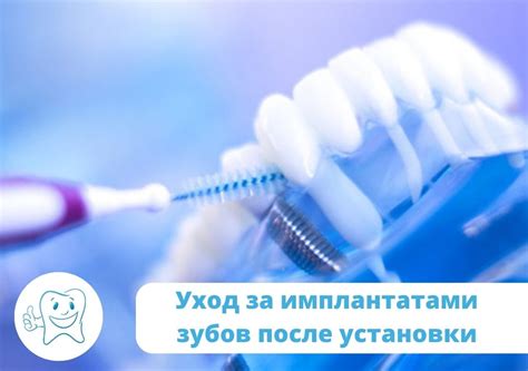 Как ухаживать за имплантами зубов после процедуры в Подольске Стоматология Улыбка