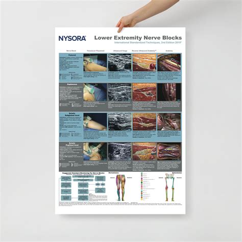 Lower Extremity Nerve Blocks Poster Cm Nysora