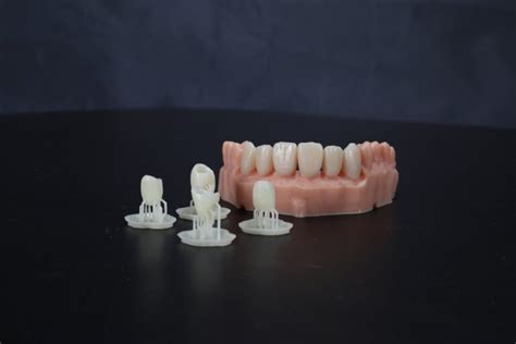 3d Printing Dental Crowns All You Need To Know Piocreat 3d