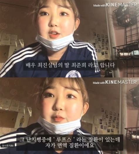 故 최진실 딸 최준희 루푸스병 투병 고백안타까운 근황