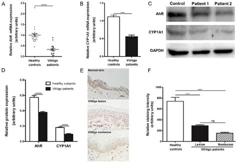 Ahr Expression Is Decreased In The Cd4 T Cells And Skin Of Patients Download Scientific