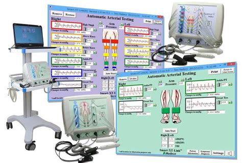 Hadeco Smartdop Xt Damarus Panen Utama