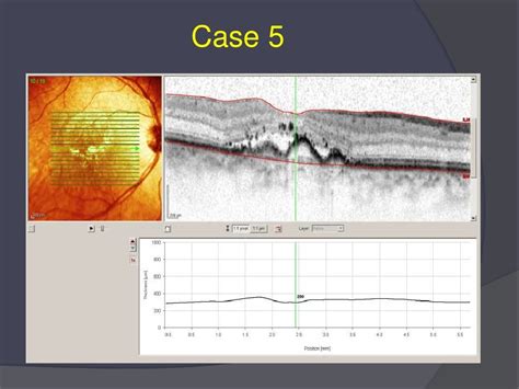 Advances In Amd And Oct
