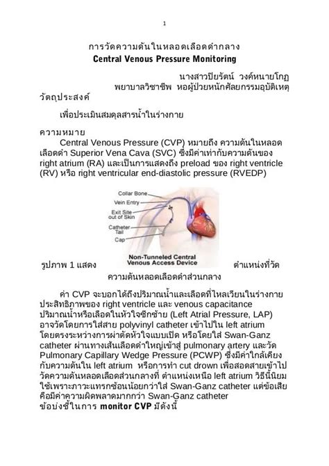 Central Venous Pressure Cvp
