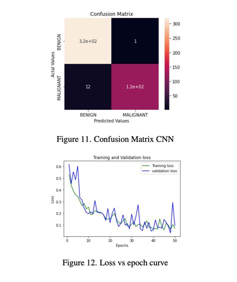GitHub Vikhyat Github Melanoma Skin Cancer Detection This Is A Project About Melanoma