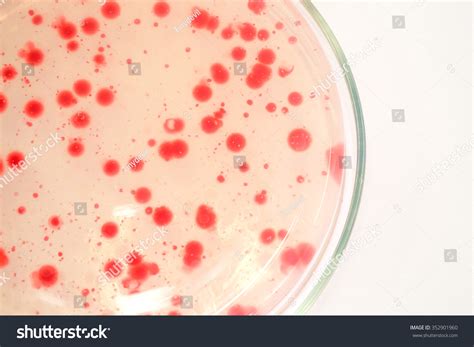 Microbiology Laboratory Test Stock Photo Shutterstock