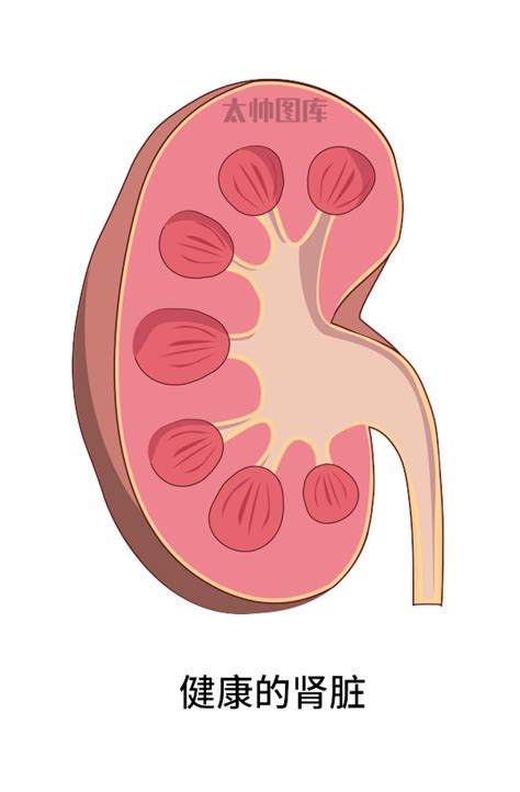肾 医学插画