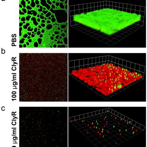 Confocal Laser Scanning Microscope Clsm Analysis Of E Faecalis