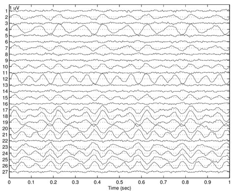 Simulated Eeg Signals Measured At The 27 Electrodes Download Scientific Diagram