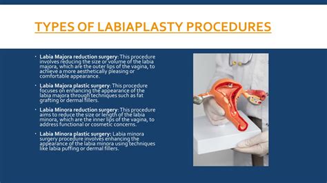 Ppt Reclaim Your Comfort And Confidence With Labiaplasty Surgery Powerpoint Presentation Id