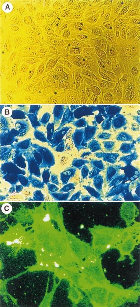 Histochemical Staining With Gal Substrate X Gal And Fitc Fluorescence
