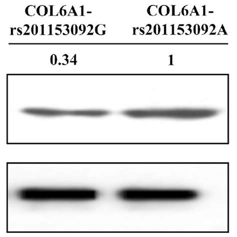 Protein expression of COL6A1. The expression levels of COL6A1 proteins ...