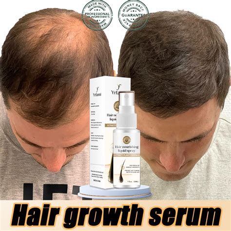 Hair Growth Serum Fast Hair Growth Hair Thickener And Grower For Hair